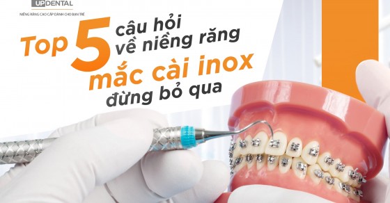 Đặc điểm và ưu điểm của răng inox trong điều trị nha khoa