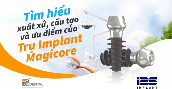 Trụ Implant MagiCore (Hàn Quốc) - Chi phí và ưu điểm | Up Dental