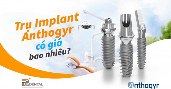 Trụ Implant Anthogyr (Pháp) - Chi phí và ưu điểm | Up Dental